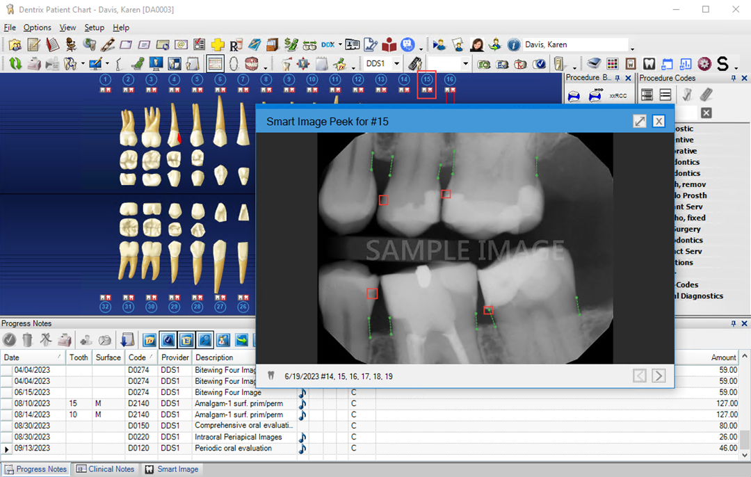 Accessing Dentrix Detect AI images from the Patient Chart