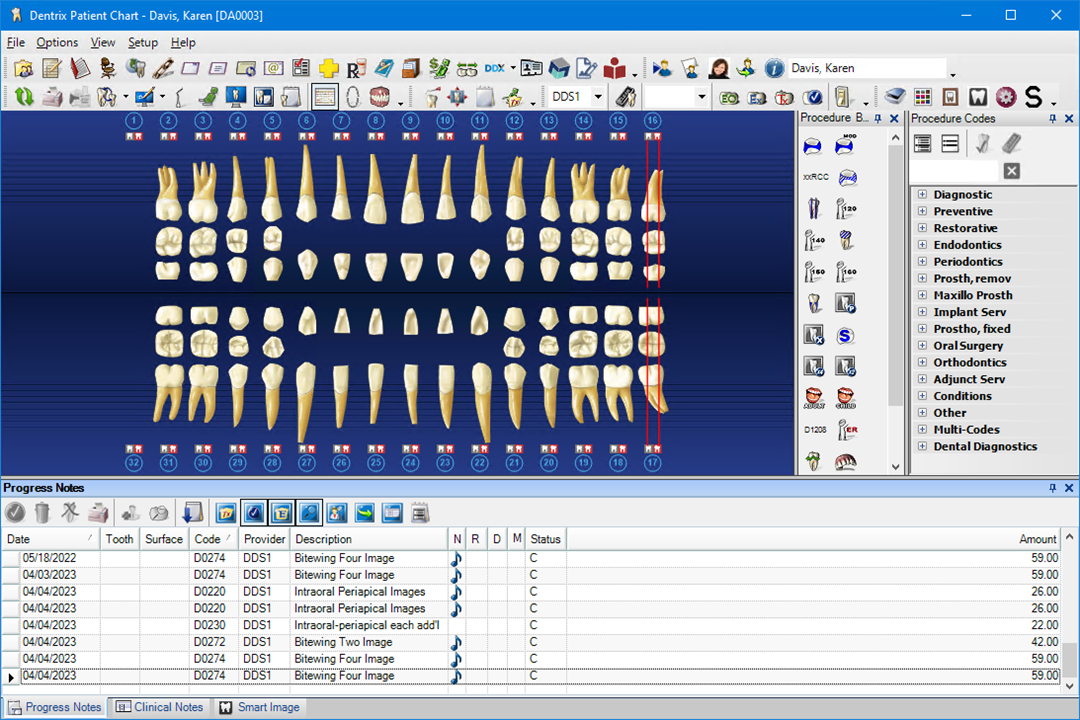 Changing to the Work Chart layout