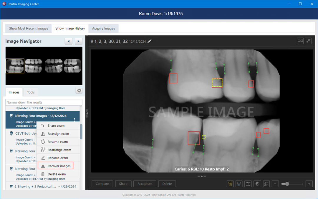 Recovering images