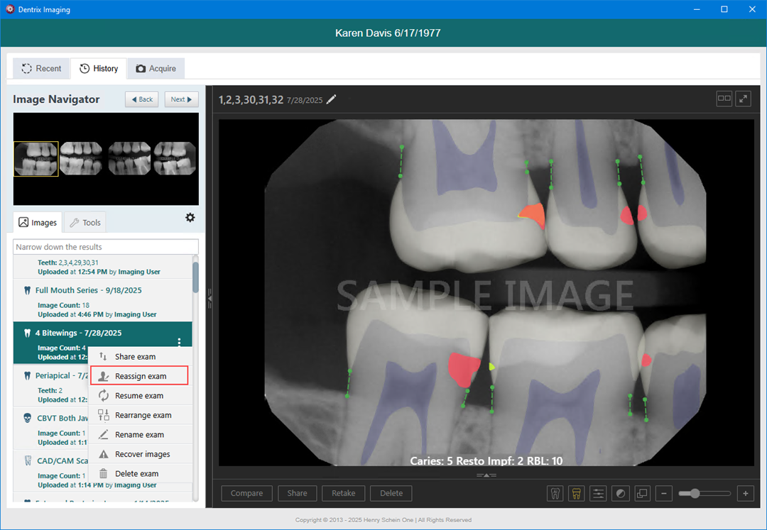 Reassigning images to a different patient