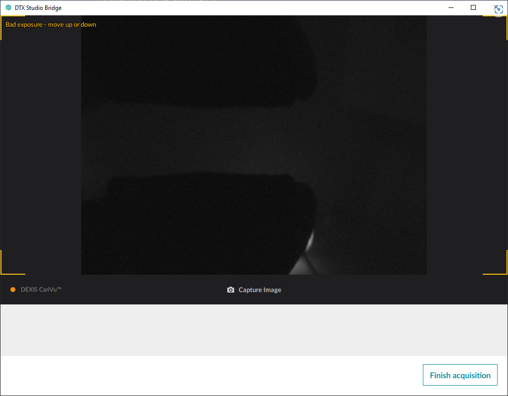 Setting up the DEXIS DEXcam 4 HD camera