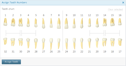 Setting up the DEXIS DEXcam 4 HD camera