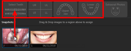 Setting up the DEXIS DEXcam 4 HD camera
