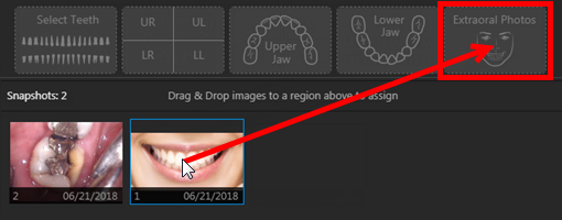 Setting up the DEXIS DEXcam 4 HD camera