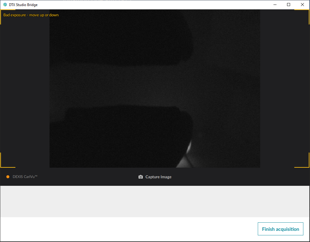 Setting up the DEXIS CariVu camera
