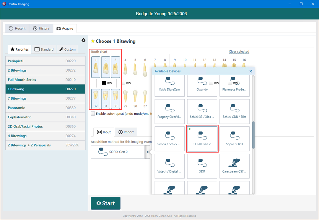 Setting up the Acteon Sopro SOPIX gen 2 sensor
