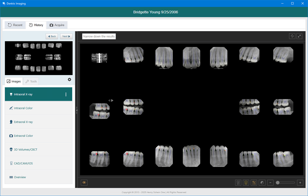 Acquiring images using Simple Mode