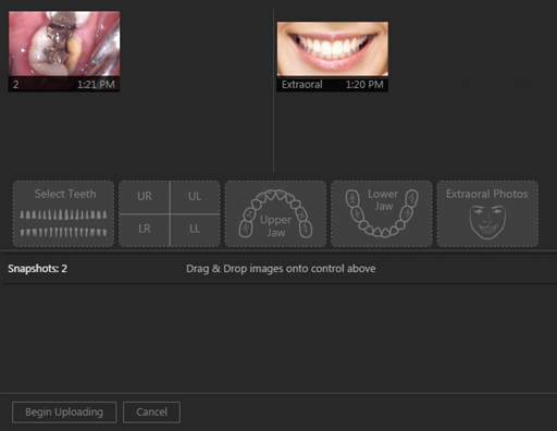 Setting up the Digital Doc Iris HD camera