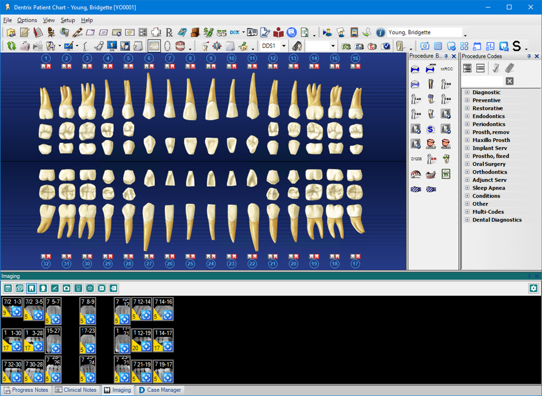 Acquiring images using Simple Mode