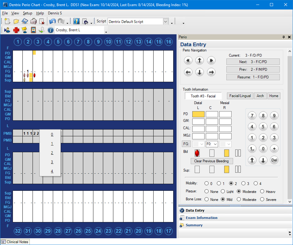 Charting bone loss, plaque, mobility, and furcation