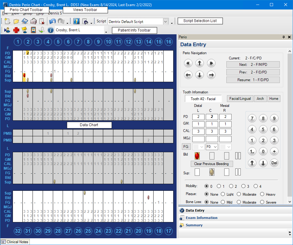 Perio Chart overview