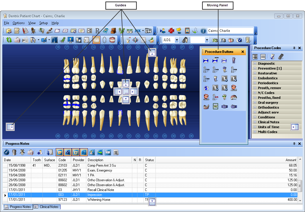 Patient Chart - Repositioning the Patient Chart panels
