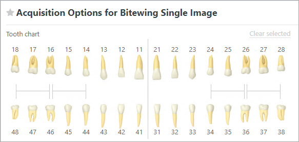 Setting up the Soredex Digora Optime scanner