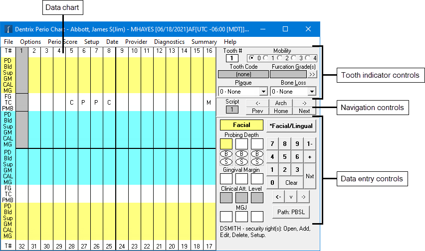 Perio Chart window overview